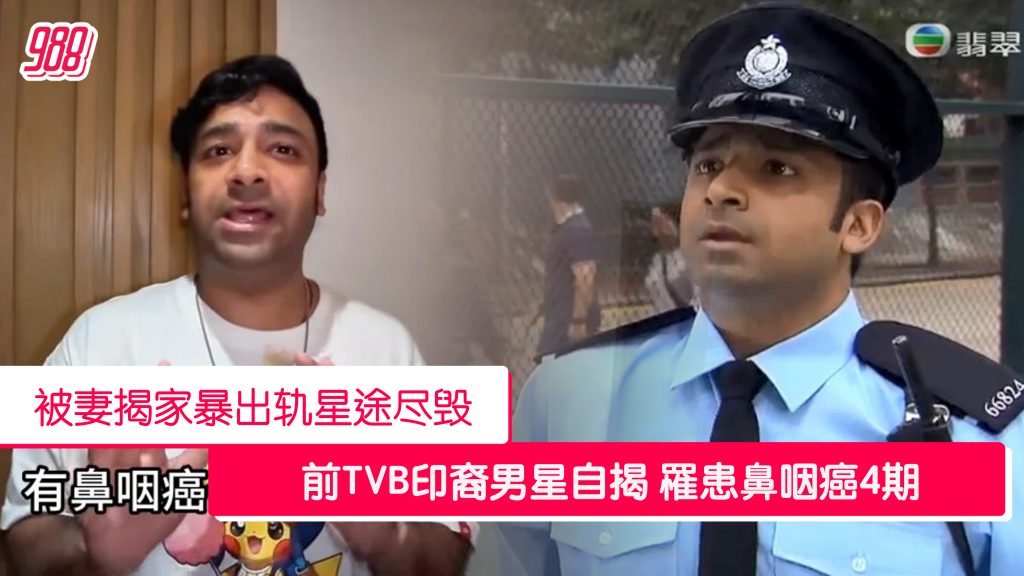 前TVB印裔男星自揭 罹患鼻咽癌4期 – 988