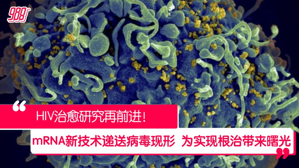 mRNA新技术递送病毒现形 为实现根治HIV带来曙光！ – 988